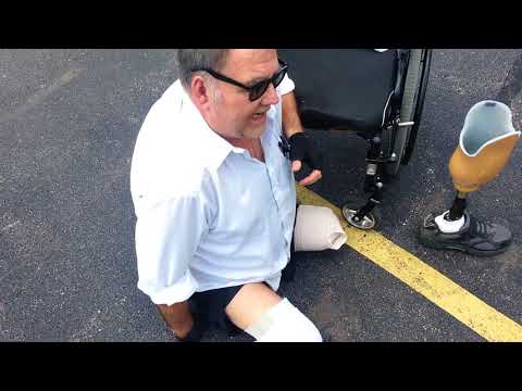 104 Flipped over in wheelchair-- How to recover--AKA BKA amputee