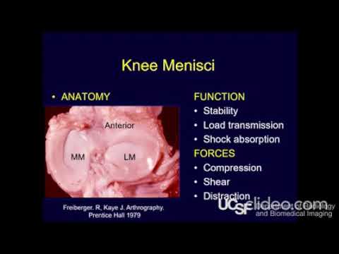 UCSF Neuro & Musculoskeletal Imaging 2024 - 13 MRI of Knee Menisci Pearls & Pitfalls