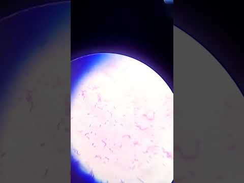 Lactobacillus sp. & Streptococcus sp. under microscope 🔬