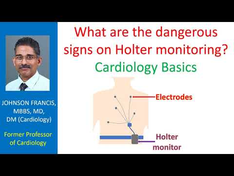 What are the dangerous signs on Holter monitoring? Cardiology Basics