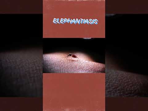 elephant leg? Part 1