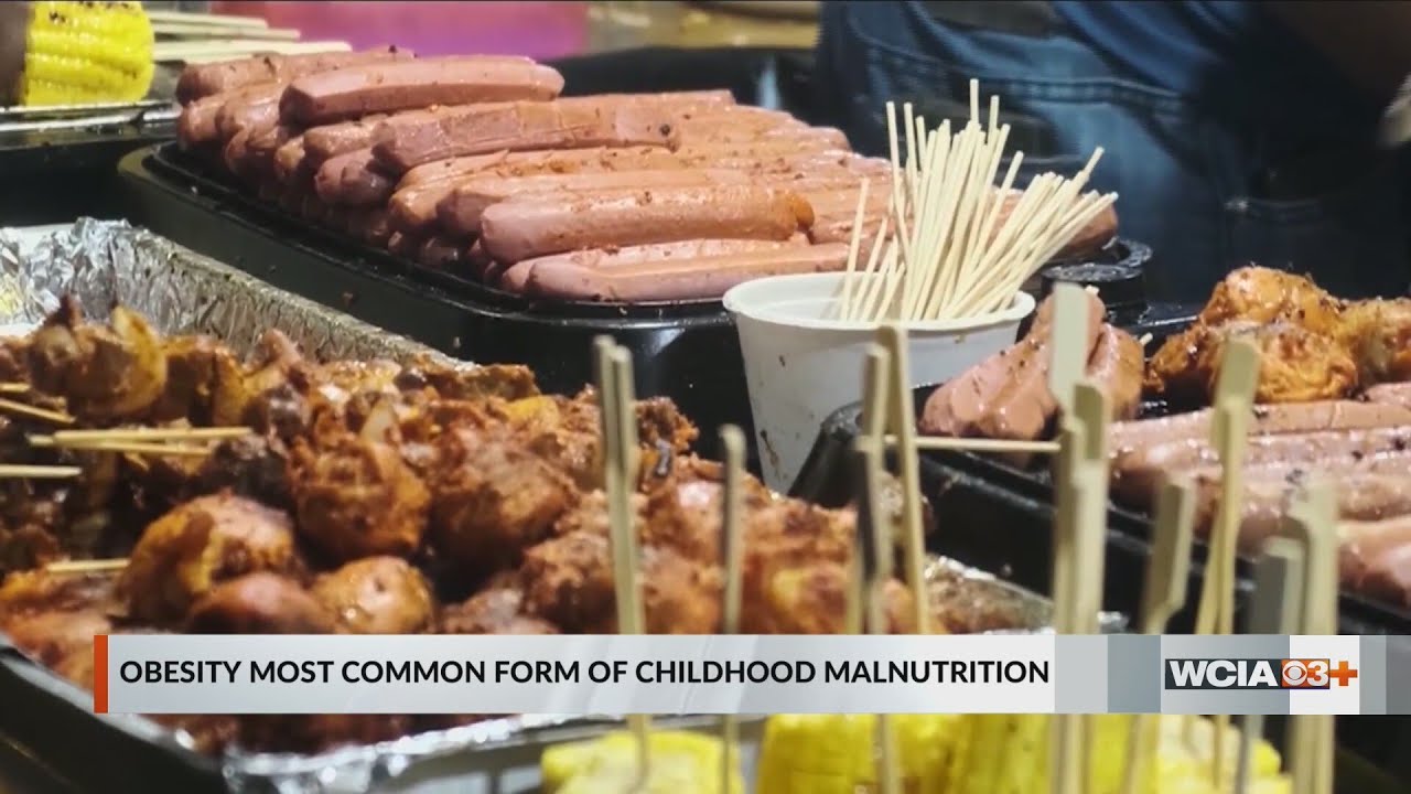 Childhood obesity surpasses being underweight as most common form of malnutrition