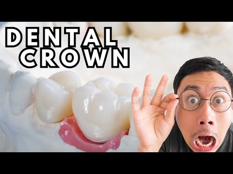 Dental Crown Procedure Animation EXPLAINED