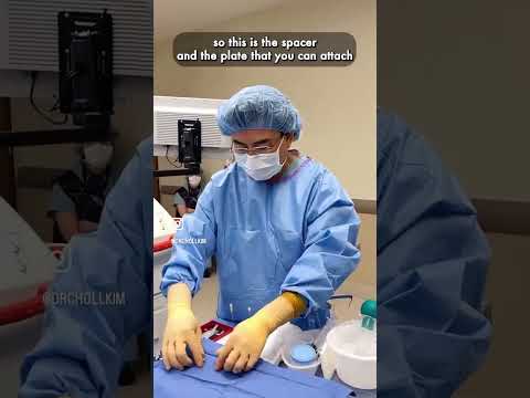 What makes my ACDF minimally invasive #shorts
