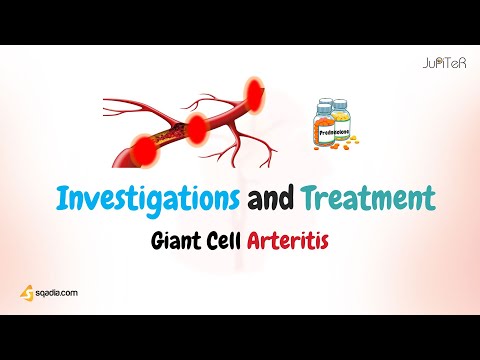 Giant Cell Arteritis | Investigations and Treatment
