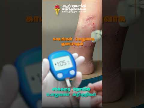 Symptoms of Diabetes -சர்க்கரை நோயின் அறிகுறிகள் #melmaruvathur#doctor#adhiparasakthihospitals#tamil