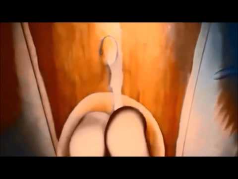 Laparoscopic Incisional Hernia Repair - English