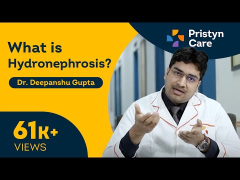 What is Hydronephrosis? | Swelling of Kidney - For FREE Consultation Call On 08065105262
