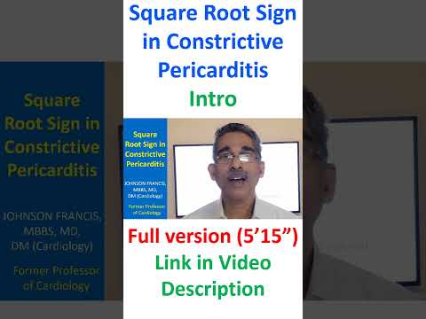 Square Root Sign in Constrictive Pericarditis