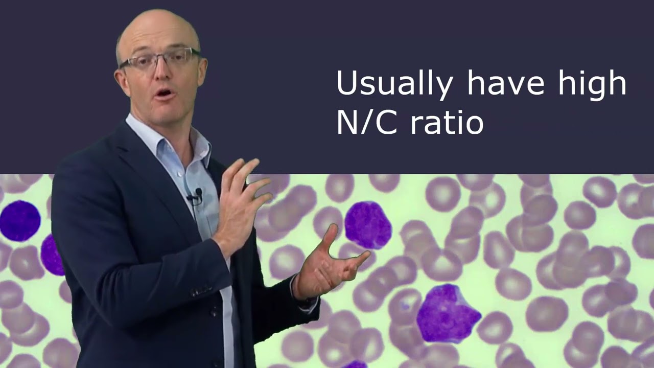 Blast or atypical lymphocyte? How you can pick the difference