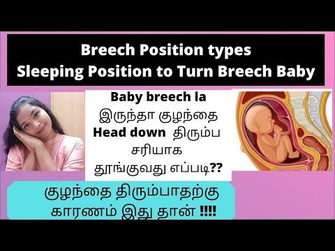 Breech position types|Sleeping position to turn breech baby in Tamil|Reason for baby Breech position