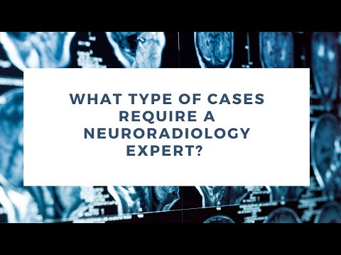 Dr Kieran Hogarth - what type of cases require a neuroradiologist expert opinion?