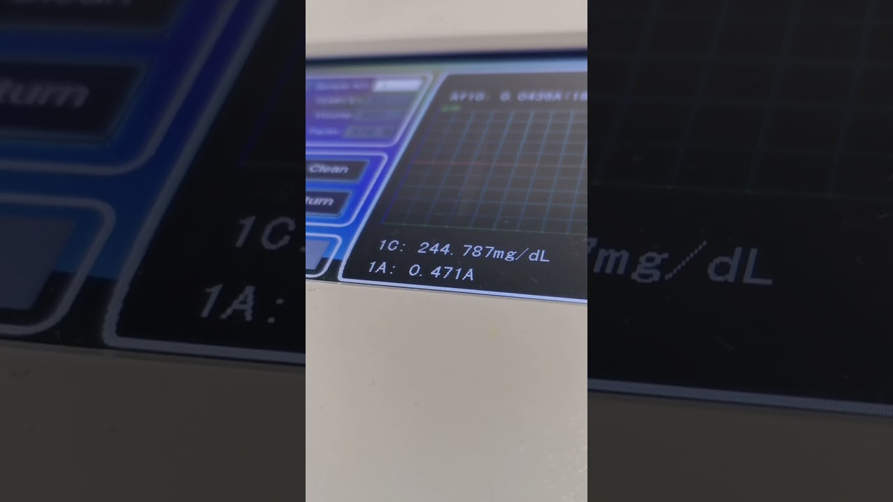 How to do Cholesterol Test #laboratory #medtechstudent #mls #cls #medtech #chemistryanalyzer #chole