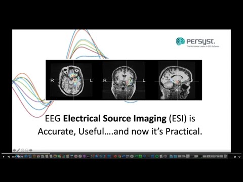 Persyst ESI, powered by Epilog