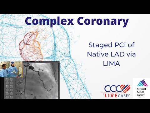Staged PCI of Native LAD via LIMA - October 18, 2011 Webcast Video
