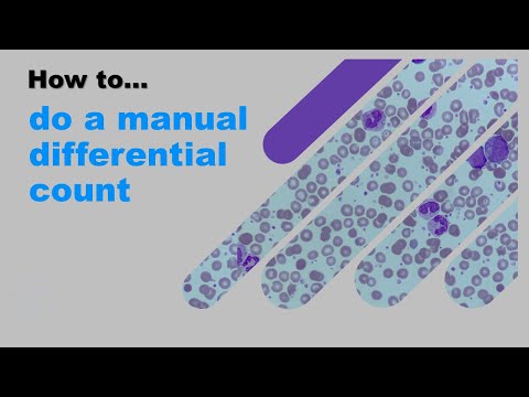 How to do a manual differential count