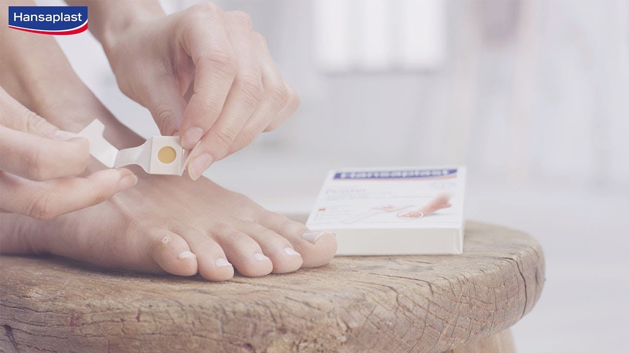 Hard On Big Toe Corn