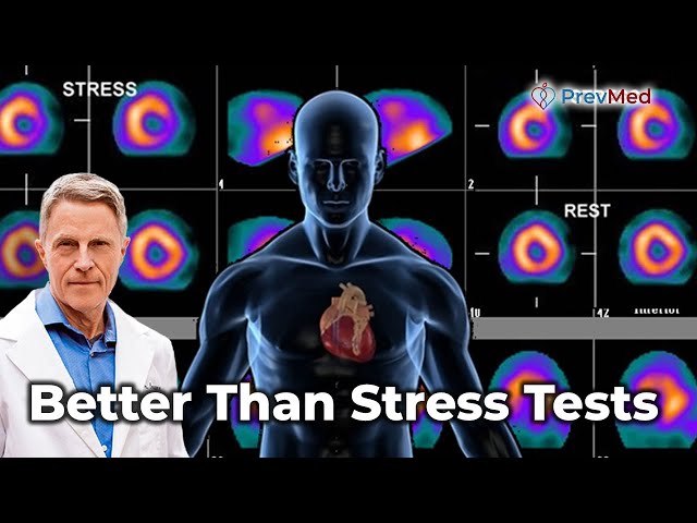 Understanding Nuclear Stress Tests: Are They Worth It? | Galaxy
