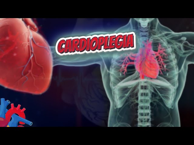 Anesthesia - Plegiocard, Cardioplegia Solution Injection Trader ...