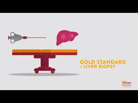 Biopsy: the gold standard for NASH diagnosis