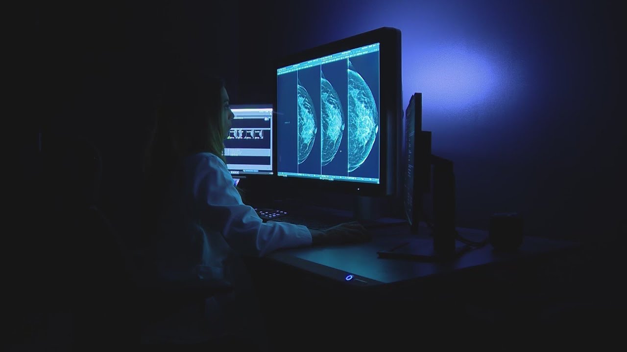New guidelines for mammograms