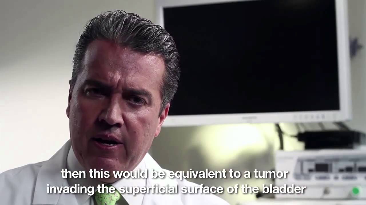 Bladder cancer by Dr. René Sotelo