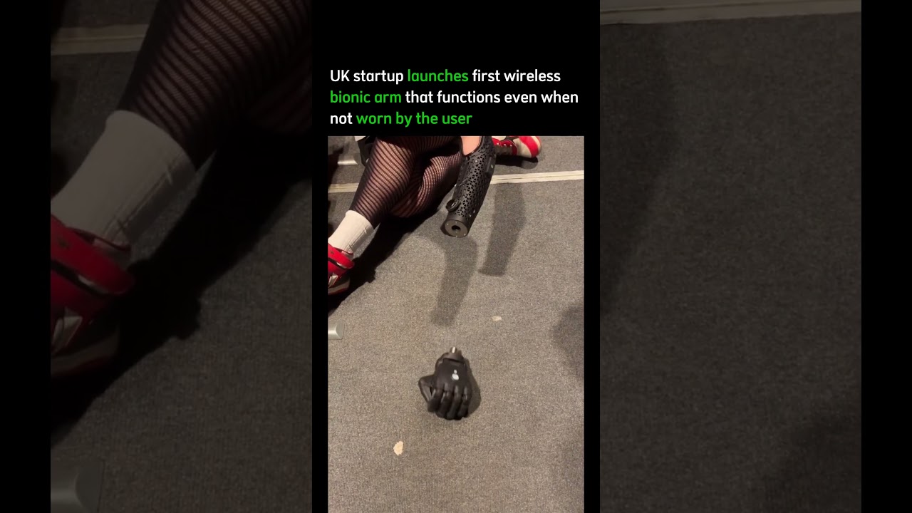 World’s First Wireless Bionic Arm That Works Without Being Worn!