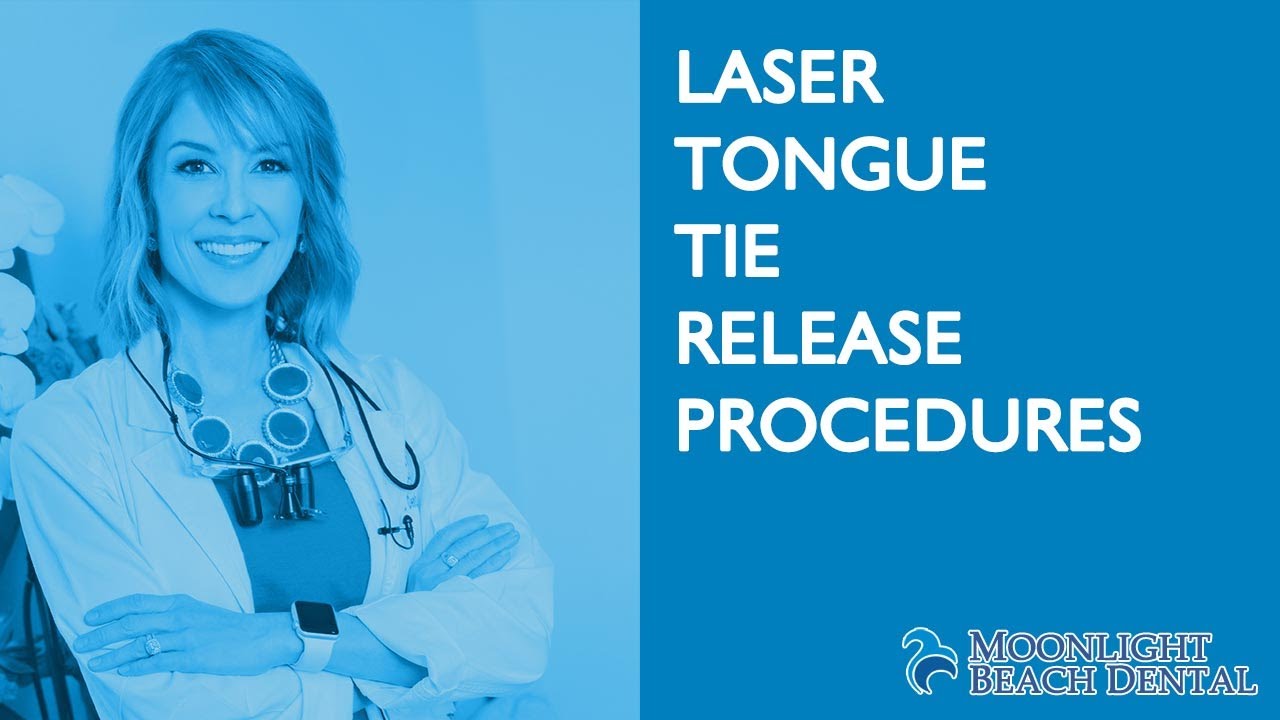 Laser Tongue Tie Release