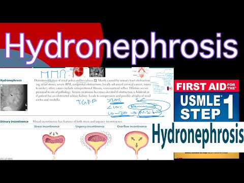 Hydronephrosis in Hindi/Urdu by first aid for USMLE step 1