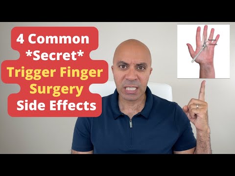 What Your Trigger Finger Surgeon Never Told You! 4 Common *Secret* Side Effects Of Surgery!