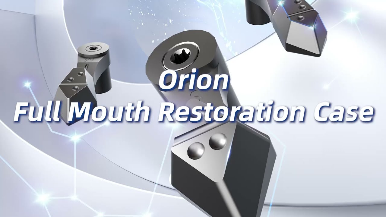 Orion in Action | Full-Arch Implant Workflow