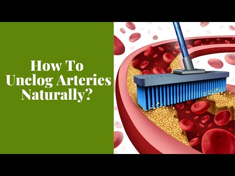 How To Unclog Arteries Naturally | Unclog Arteries | Supplements to Unclog Arteries