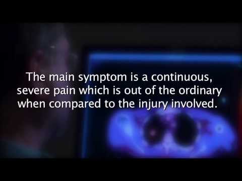RSD Attorney - What are the Stages of RSD?