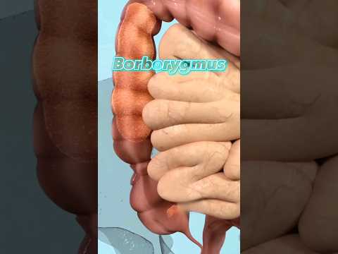 BORBORYGMUS | MEDICAL DEFINITION VOCABULARY TERMINOLOGY - Interpreter Training