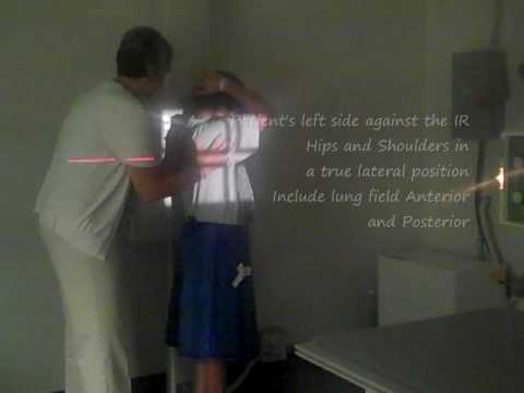 Lateral chest x ray « Medical Radiology - Canada, Winnipeg