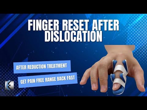 Finger Reset After Dislocation – Preferred Rehab