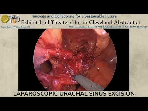 LAPAROSCOPIC URACHAL SINUS EXCISION