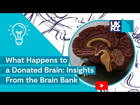 What Happens to a Donated Brain | Insights From the South West Dementia Brain Bank