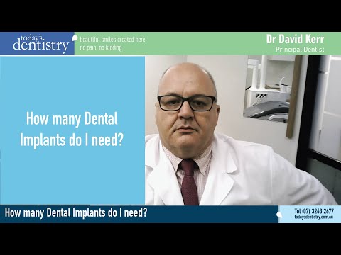 How many Dental Implants do I need?