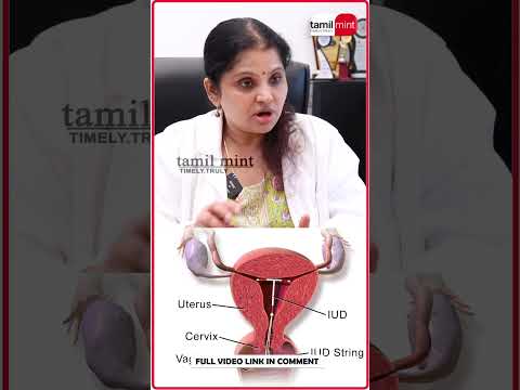 காப்பர் டி பொதுவான பக்க விளைவுகள் | Dr Vijaya Ganesh #shorts