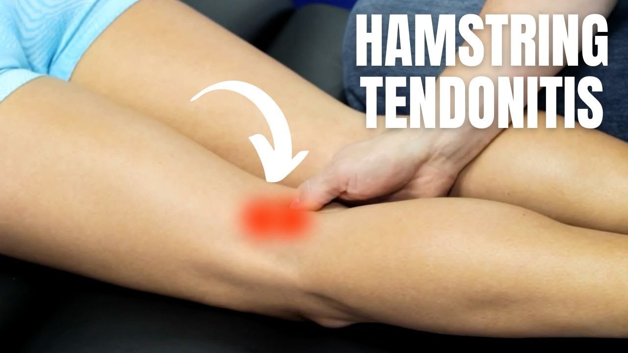 Dealing With Hamstring Tendonitis Behind The Knee While Running