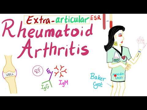 Rheumatoid arthritis (RA)- Signs and Symptoms - Extra-articular manifestations - Part 6