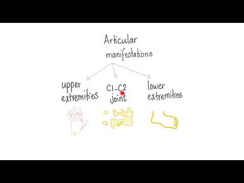 Rheumatoid Arthritis (Part 4): Clinically, Articular manifestations