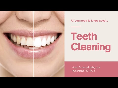 Teeth Cleaning EXPLAINED | At Home vs. Visiting the Dentist | Benefits & FAQ'S