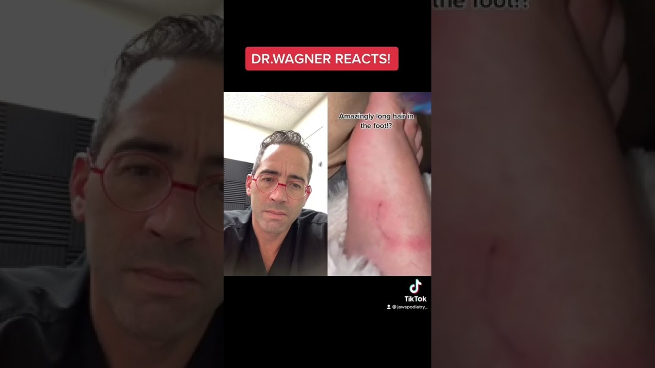 LONGEST INGROWN HAIR? 😳#shorts #ingrown #ingrownhair