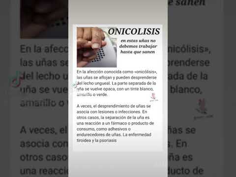 ¿Qué es la onicólisis ungueal? – LIB ASK