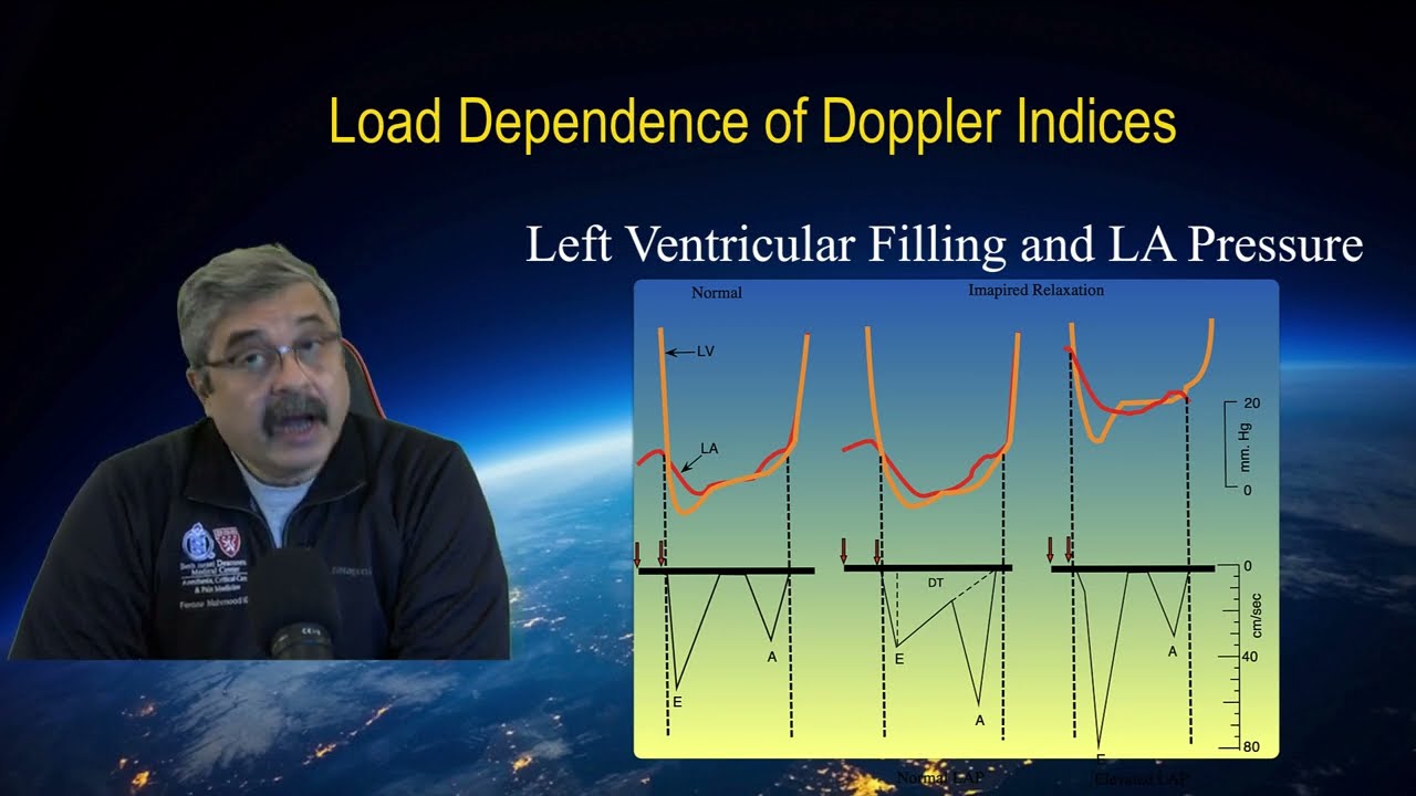 A Simplified Approach to Diastolic Dysfunction