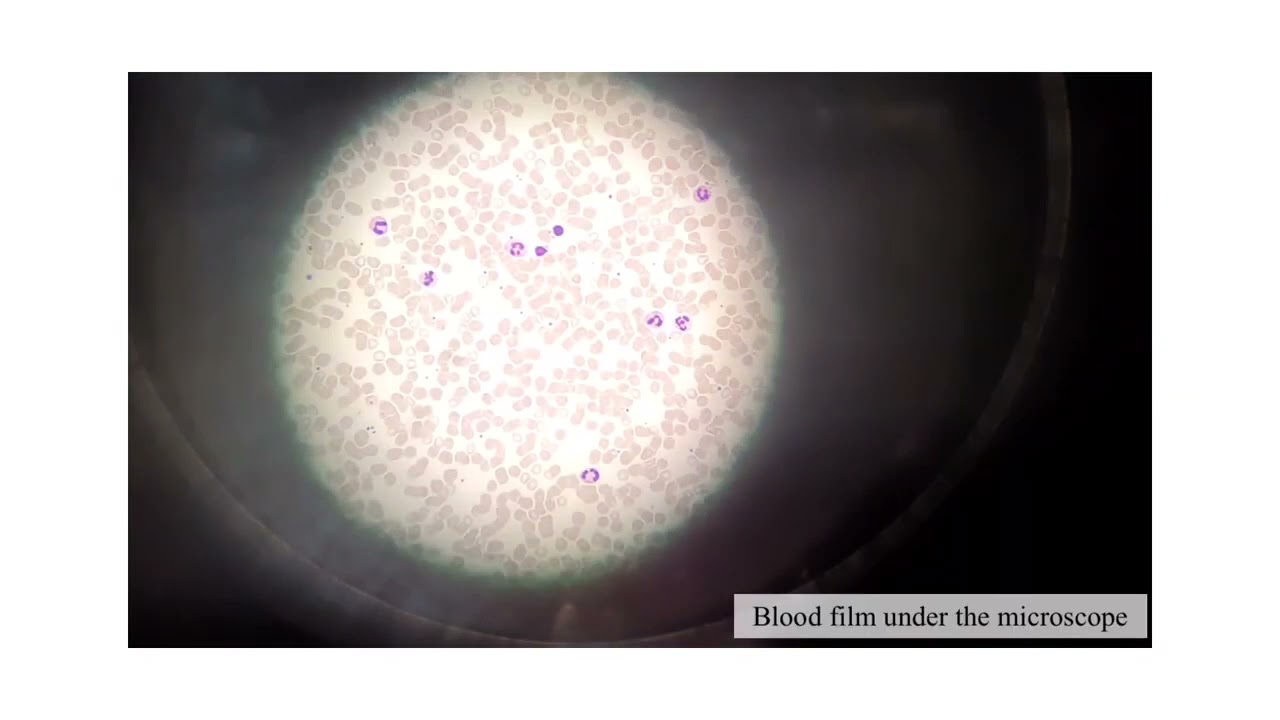 University Hospitals Sussex - Biomedical science day - Haematology and Coagulation