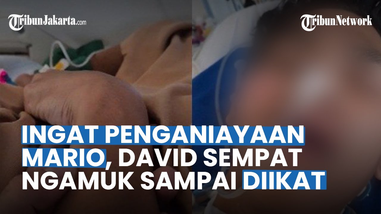 Diduga Ingat Penganiayaan yang Dilakukan Mario Dandy, David Ozora Sempat Ngamuk sampai Harus ...