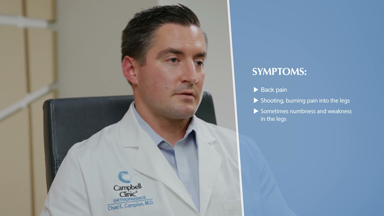 What is Sciatica with Dr. Campion